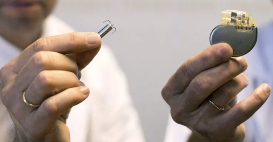 ¡HITO EN LA CARDIOLOGÍA! Implantan el primer marcapasos sin cable en ...