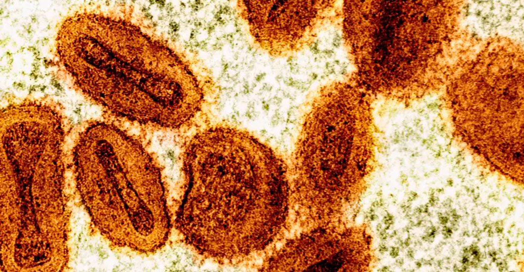 ¡PACIENTE HABÍA VIAJADO AL EXTRANJERO! Detectan en Alemania un caso de ...