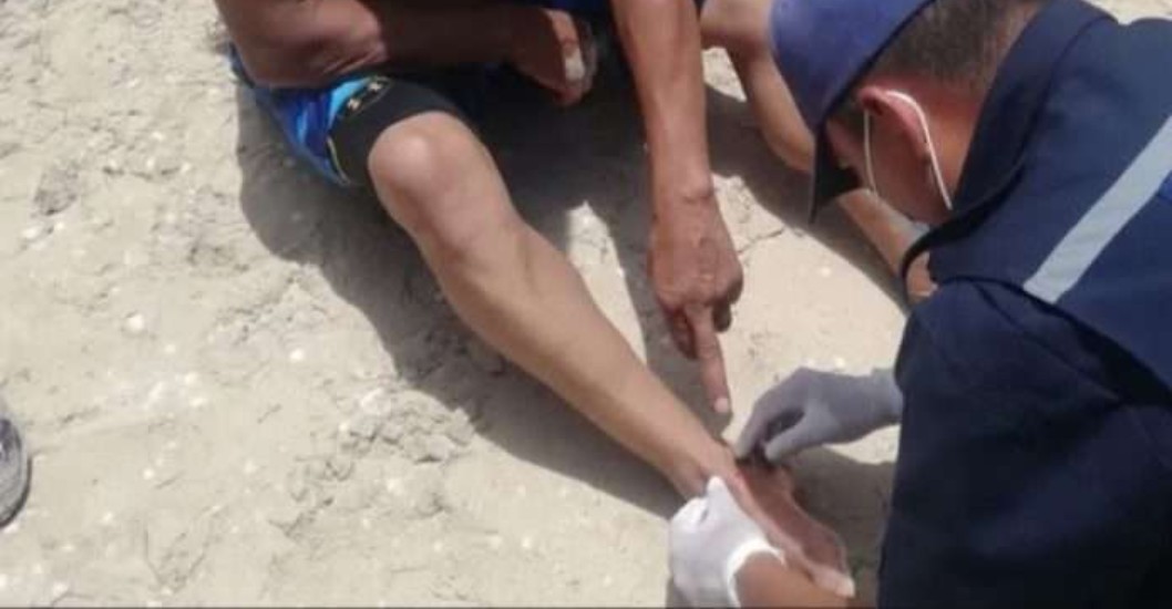 ¡CASOS EN PLAYAS NO APTAS DE MARA! Lanzan alerta por picaduras de Raya ...